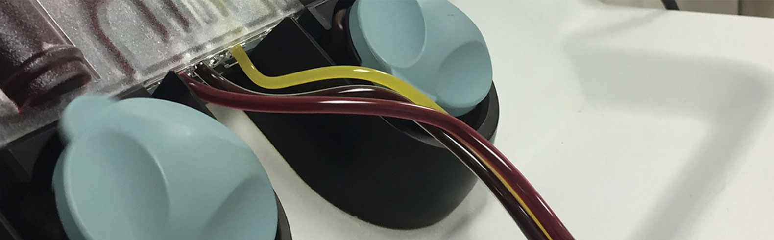 Assessment of TRIMA plasma for reconstituting cryopreserved apheresis ...